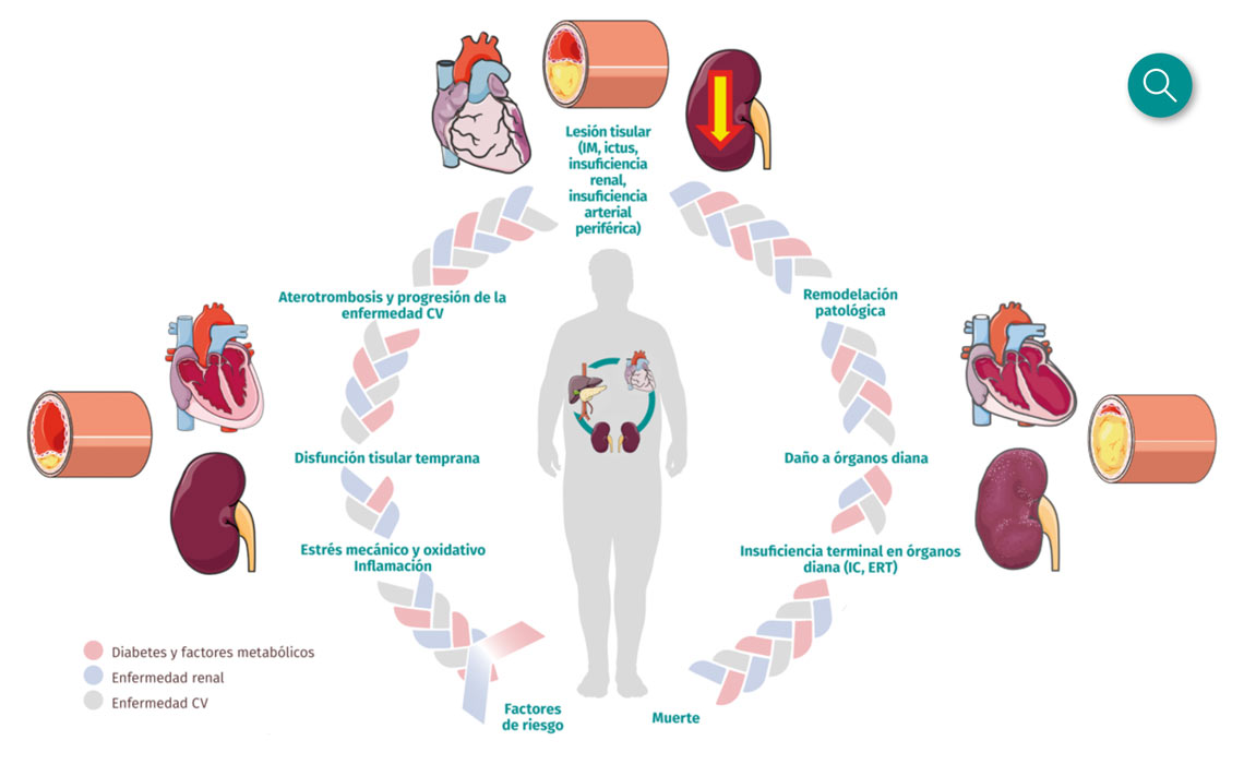 Cardiorrenal.es | Abordaje del riesgo cardiovascular en tus pacientes ...