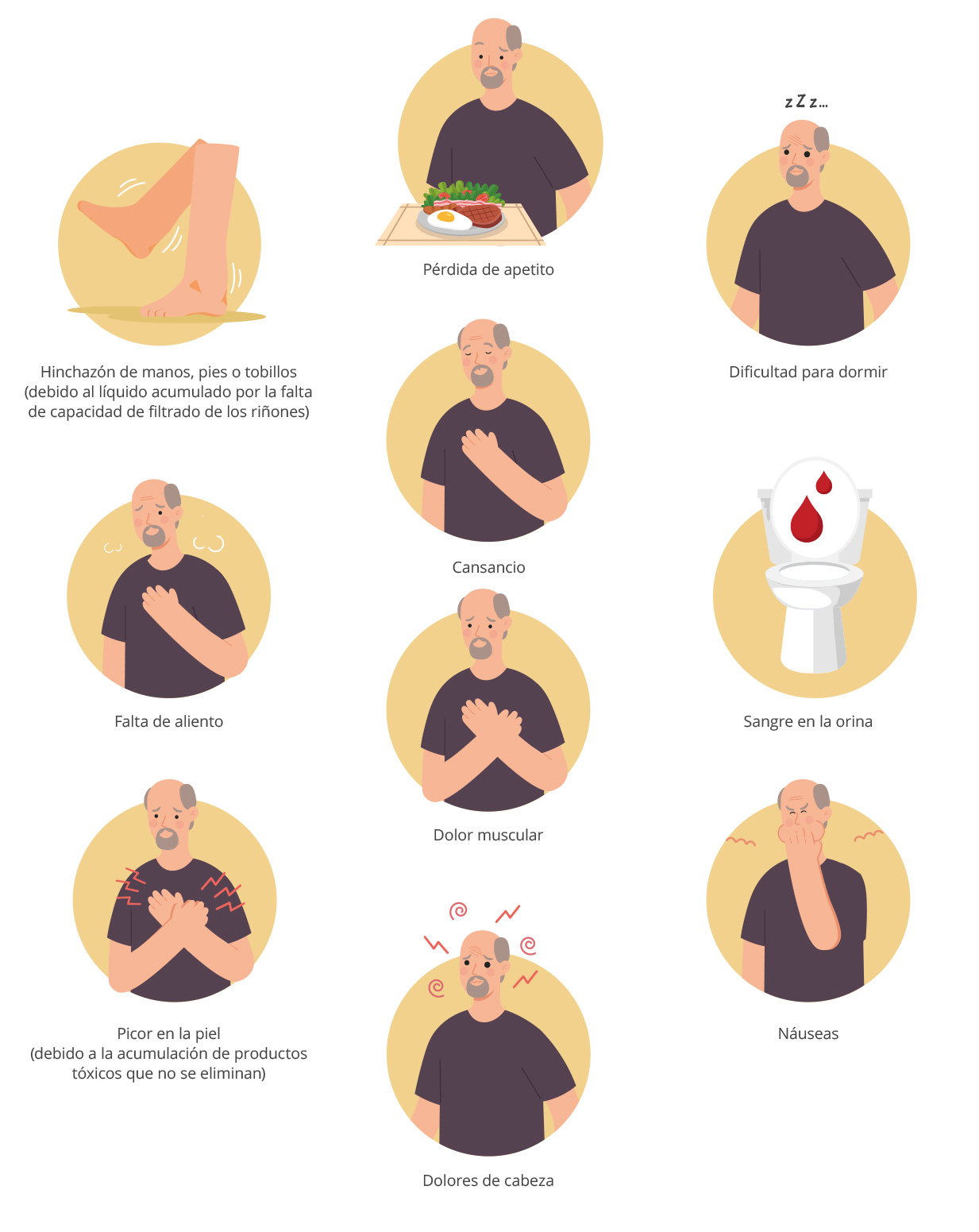 Síntomas y signos de la enfermedad renal crónica | CardioRenalMetabólico