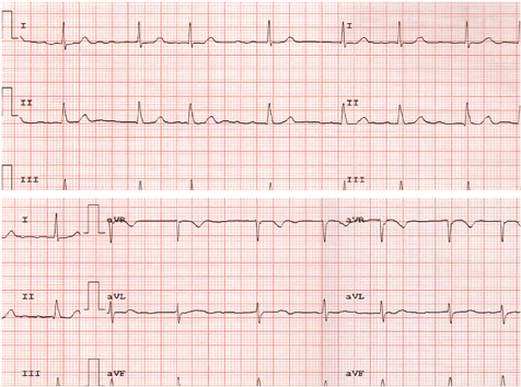Cardiorrenal.es | Actualización científica